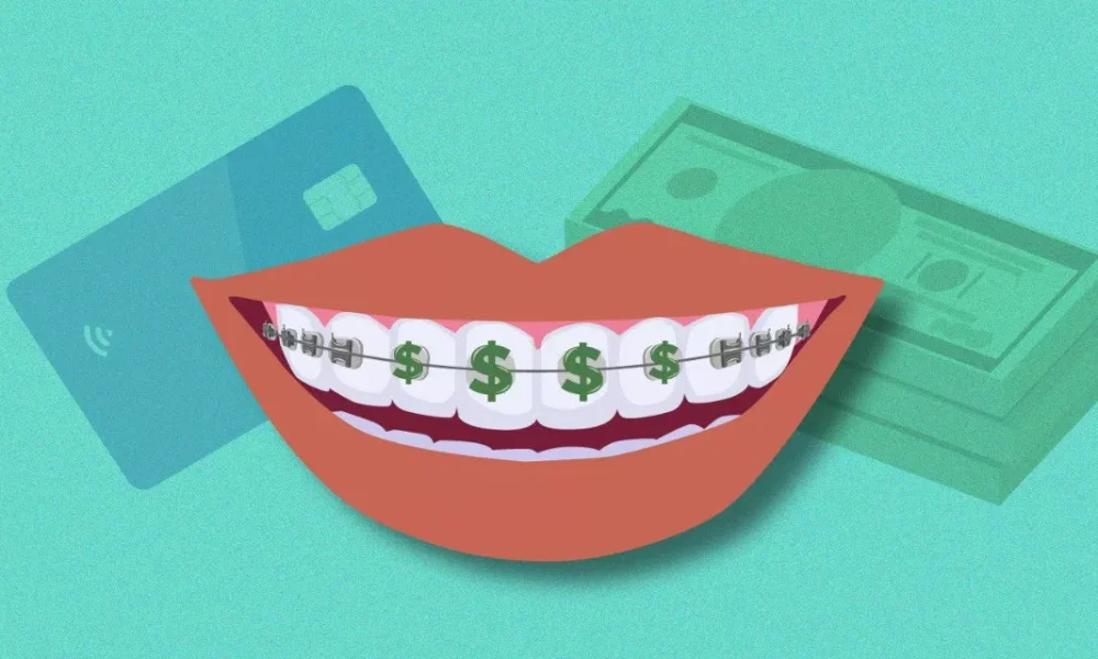 Understanding the Fine Print: Key Terms in Dental Payment Plans ...